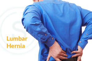 Lumbar Hernia: Symptoms, Causes & Treatments | SMILES