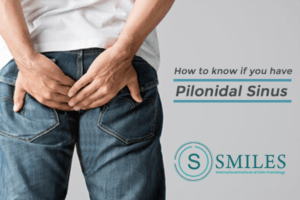 How Do You Know If You Have Pilonidal Sinus | SMILES