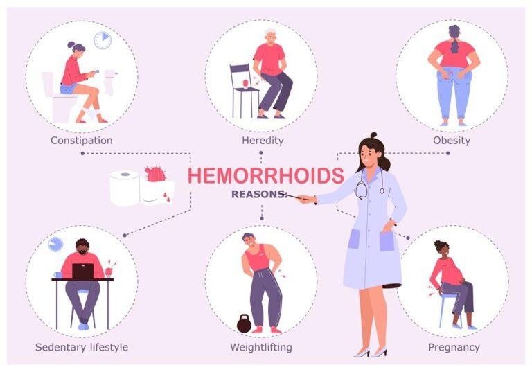 Understanding Hemorrhoid Surgery: Before and After